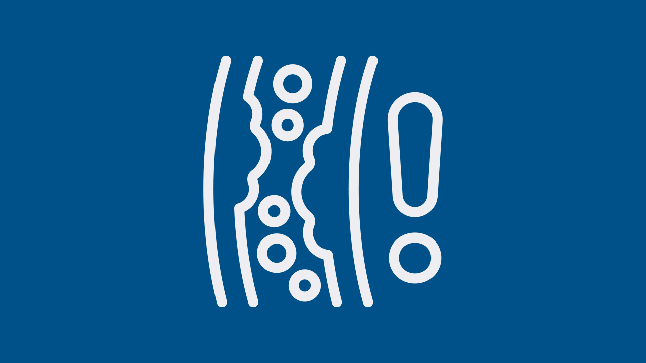 Carotid Stenosis :: New York Brain, Spine & Joint
